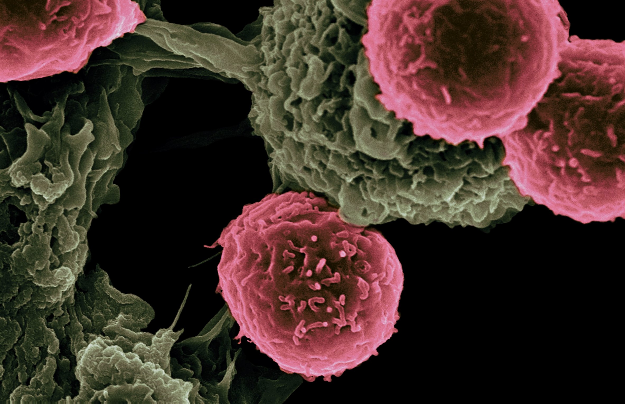 FDA clears Deciphera Pharmaceuticals’ QINLOCK™ (ripretinib) for GIST