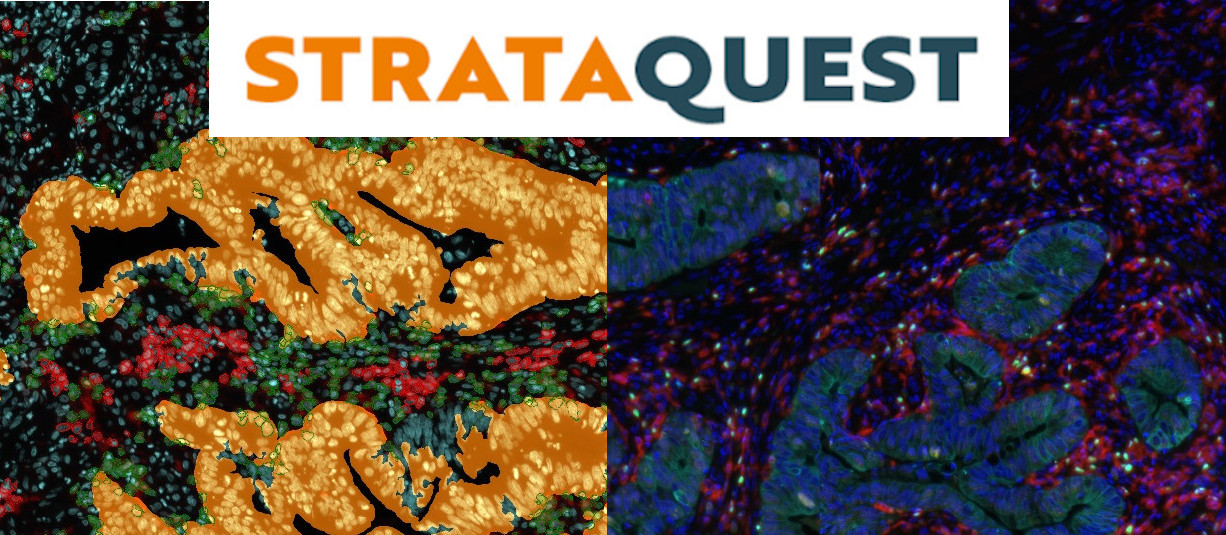 AI-Based HCS Image Analysis Software