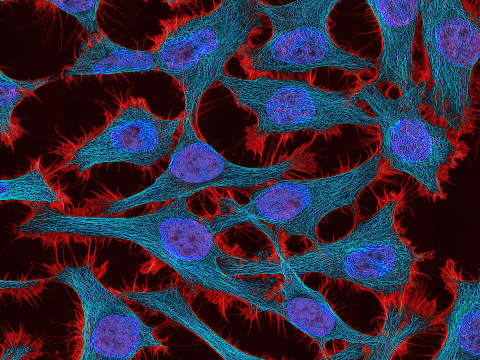 FDA Approves Antibody-drug Conjugate TIVDAK™ for Recurrent or ...