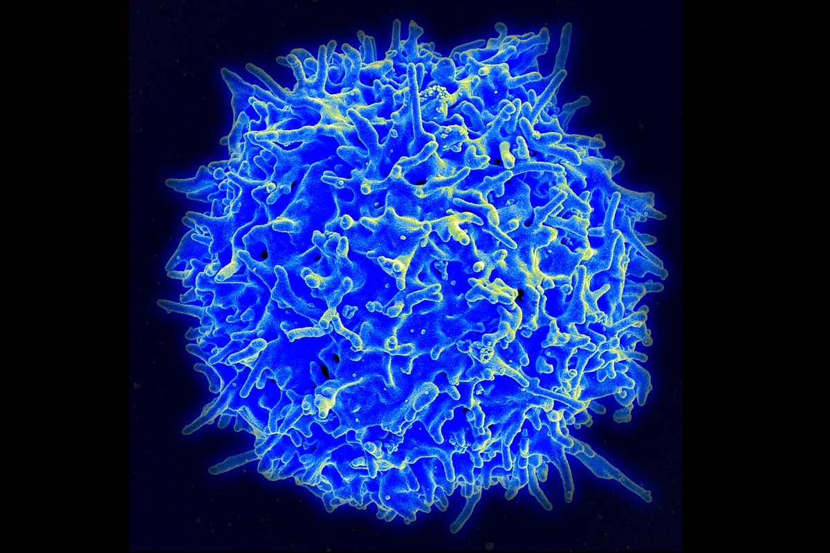 FDA OK's Tecartus® CAR T-cell Therapy for B-cell Acute Lymphoblastic ...