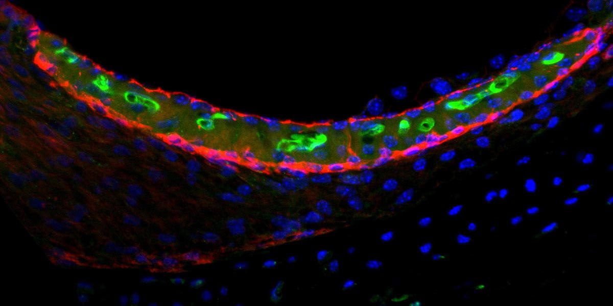 Sensorion Announces First Patient Enrolled in Phase 2a Proof of Concept Clinical Trial of SENS ...