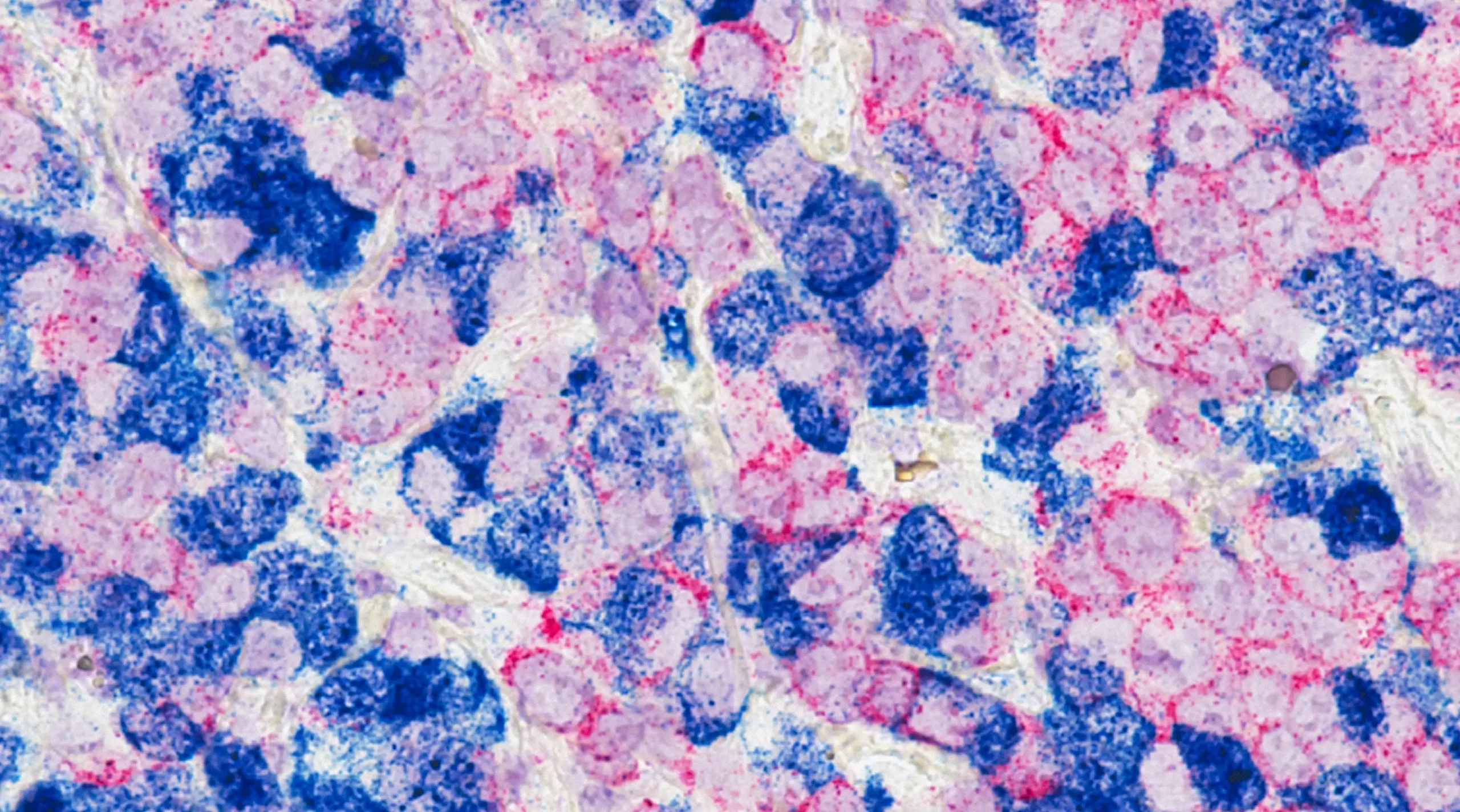 Pfizer to Accelerate Cancer Breakthroughs with $43 Billion Seagen ...