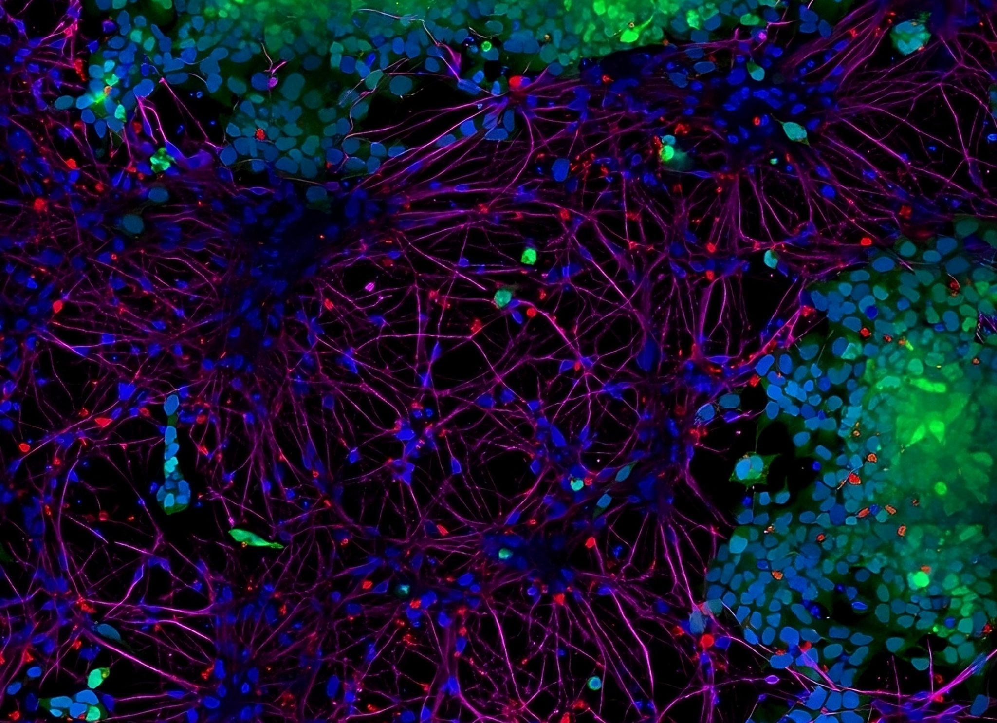 Alpha Synuclein Constructs for Neurodegenerative Disease Research