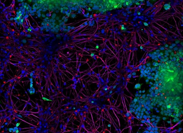Alpha Synuclein Constructs for Neurodegenerative Disease Research