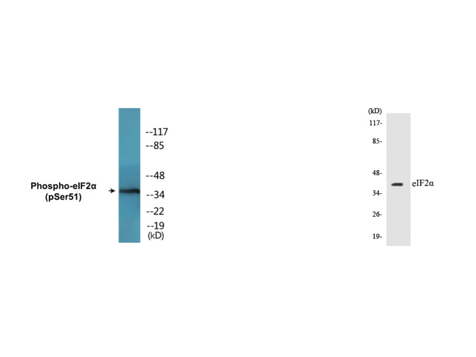 eIF2α (Phospho-Ser51) Colorimetric Cell-Based ELISA Kit