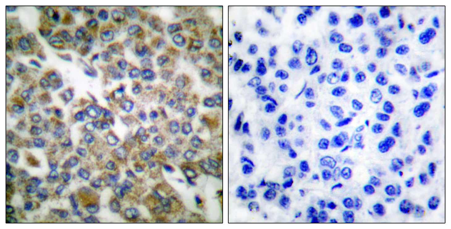 Intermediate Filament Antibodies and ELISA Kits