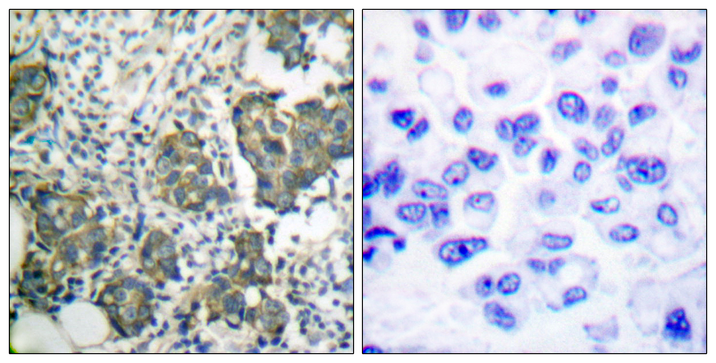 Intermediate Filament Antibodies and ELISA Kits