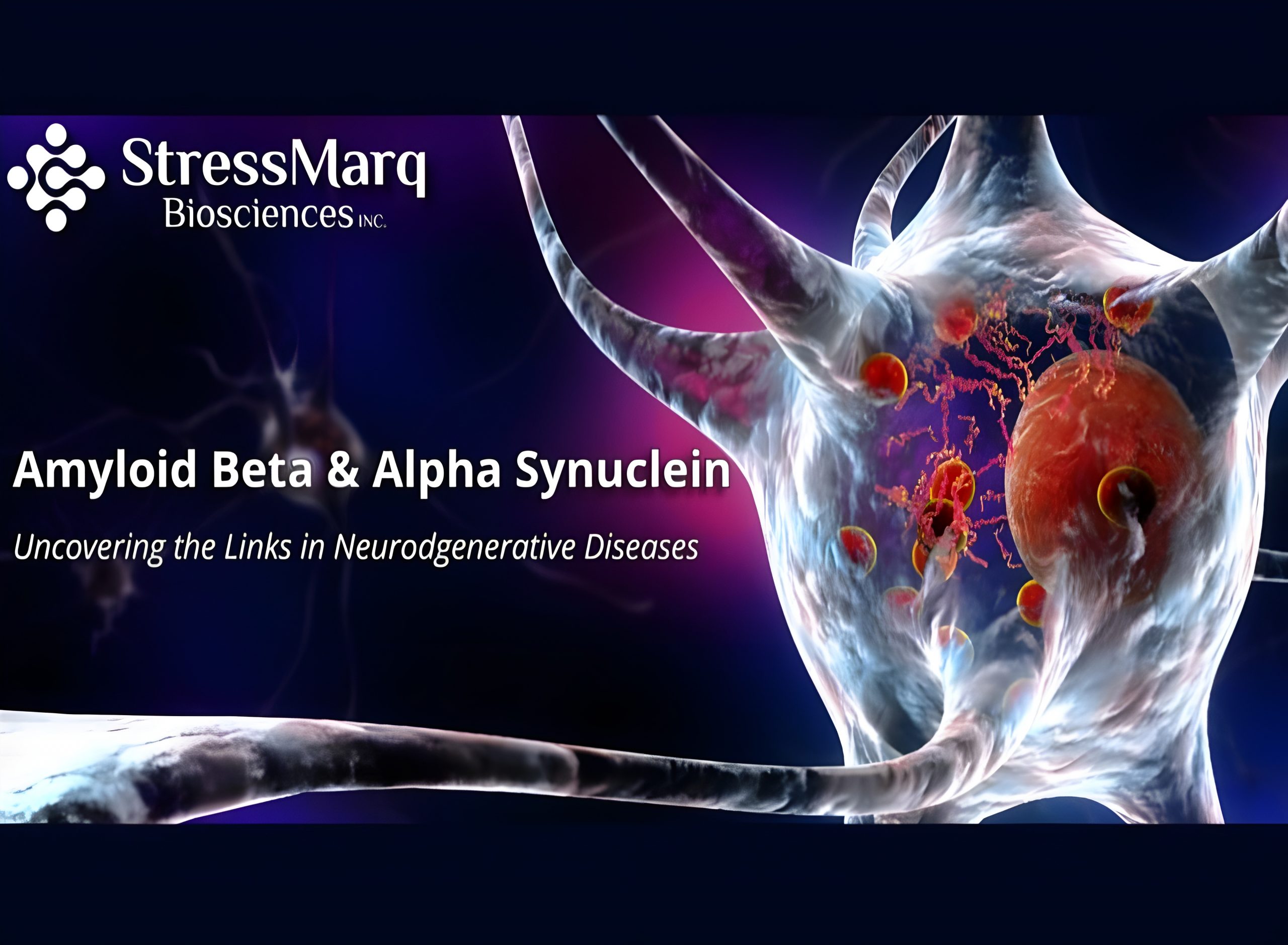 Investigating the Connections Between Amyloid Beta and Alpha Synuclein ...