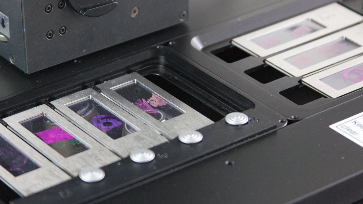 Digital Whole Slide Imaging System