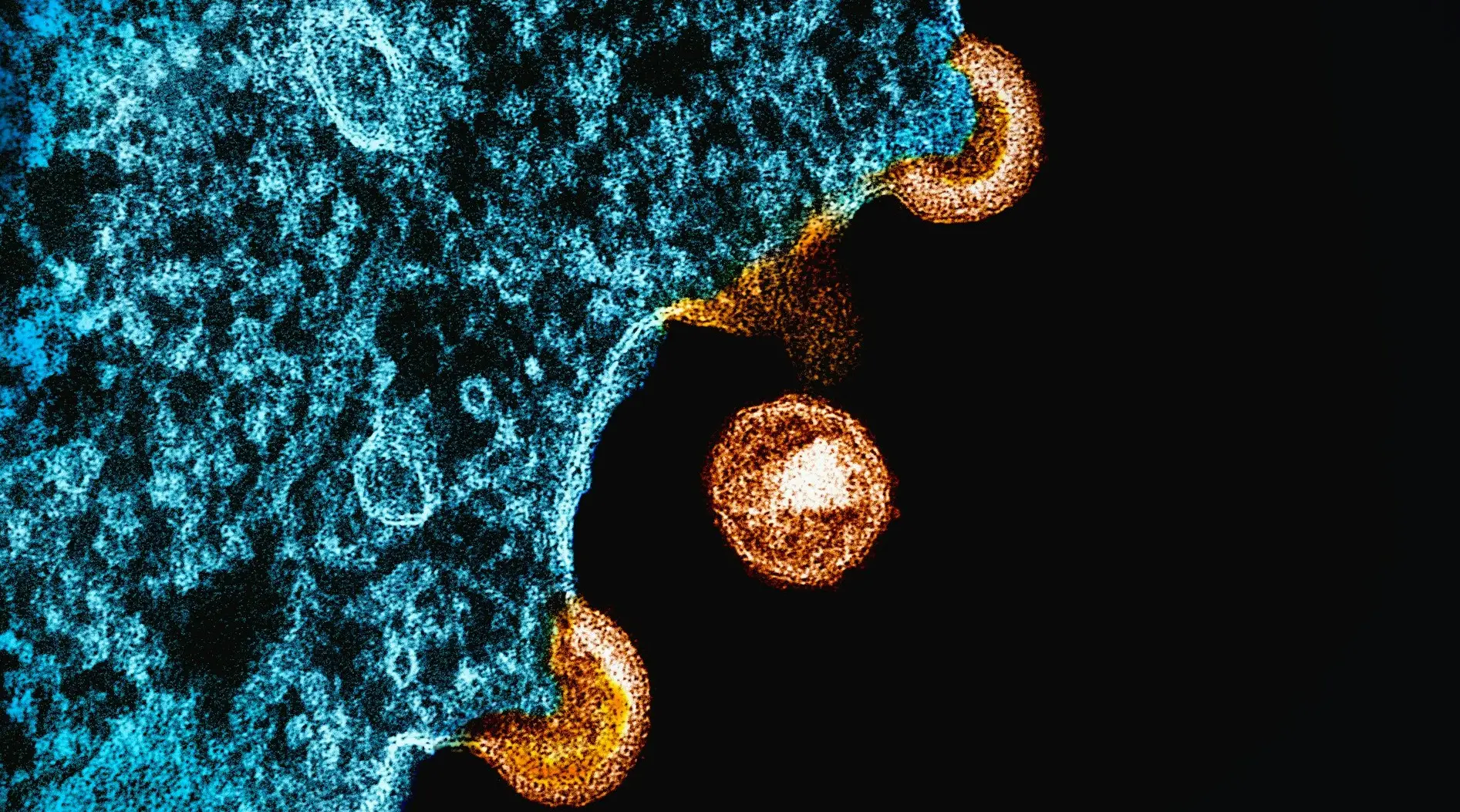FDA Approves Gilead’s Yeztugo® (Lenacapavir) as First Biannual ...