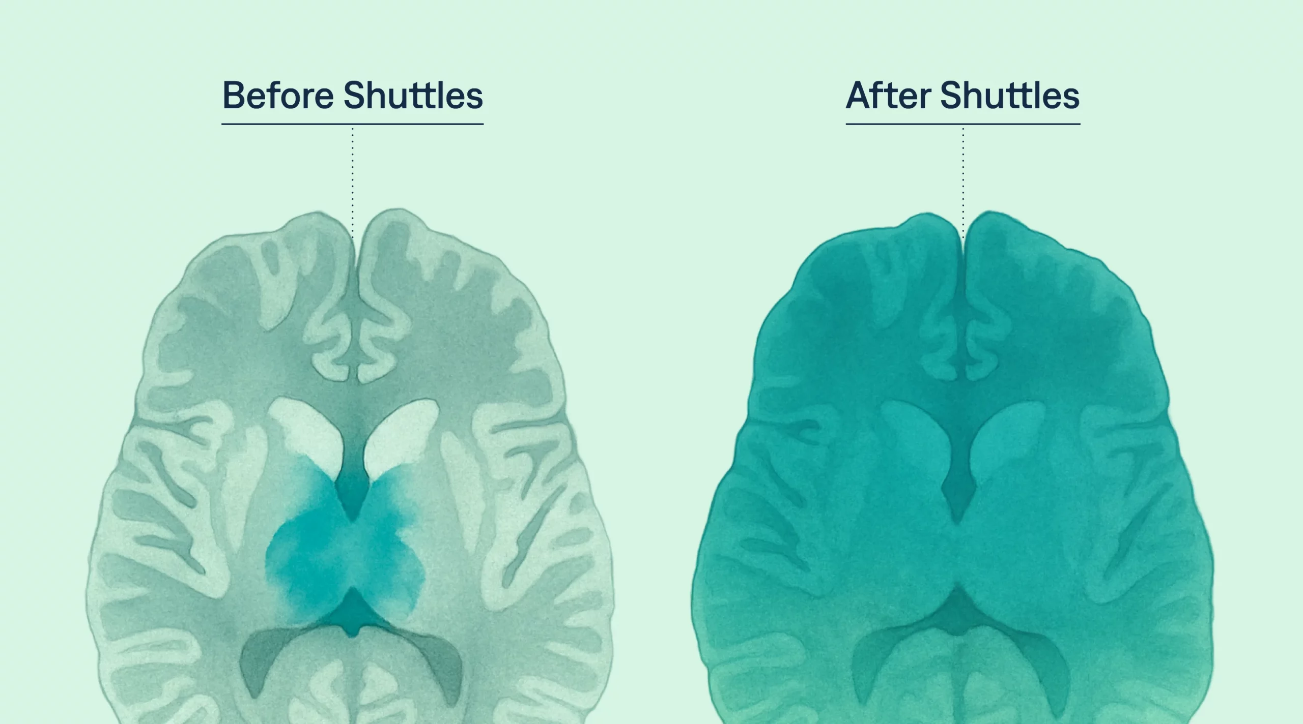 Irish Biotech Startup Aerska Secures $21M to Push Boundaries of Brain ...